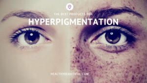 Top 5 Steps: How to Get Rid of Hyperpigmentation on Face