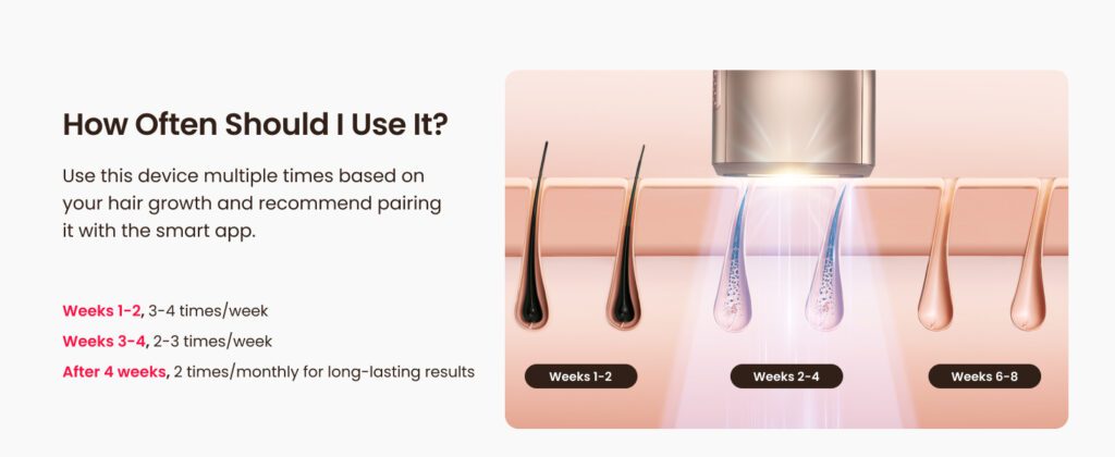 SALLOOT Trinity iGlow 10 Smart IPL: In-Depth Review by Estheticians ...